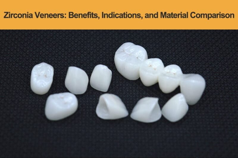 Zirconia Veneers Guide: Benefits, Indications & Comparison