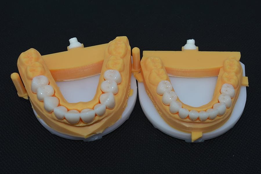 Zirconia Crowns Material: Complete Guide to Best Uses