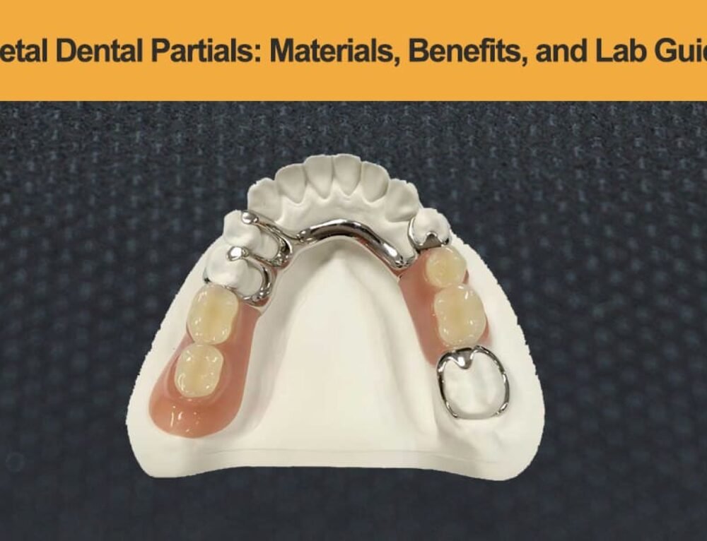 Acrylic Dentures Partial: Types, Benefits & Lab Guide